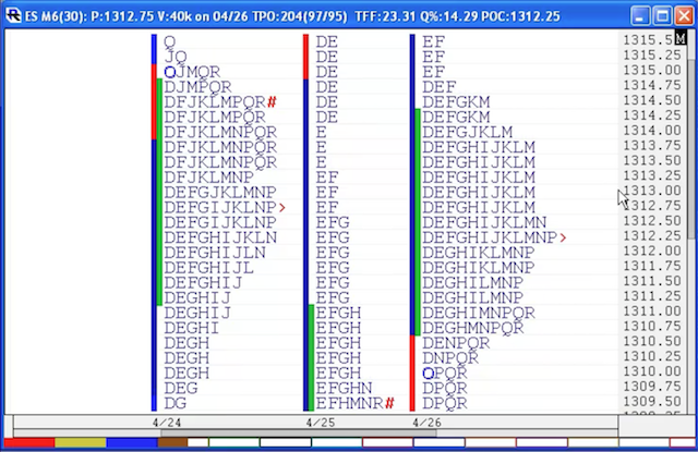 Video: TPO Profile Shortcuts | Linn Software